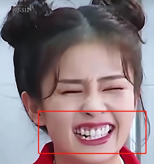 Bailu, every time I see her smile with big teeth, I can't help but ...